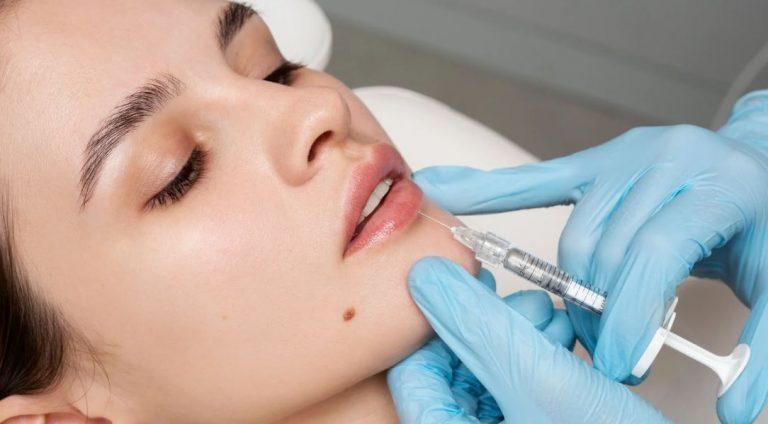 How Can a Lip Lift Transform Your Smile? - London Business Mag